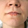 Is Herpes an Autoimmune Disease? Exploring the Link - Maggie Yu MD, IFMCP