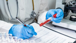 What Autoimmune Diseases Cause False Positive HIV Test - Maggie Yu MD ...